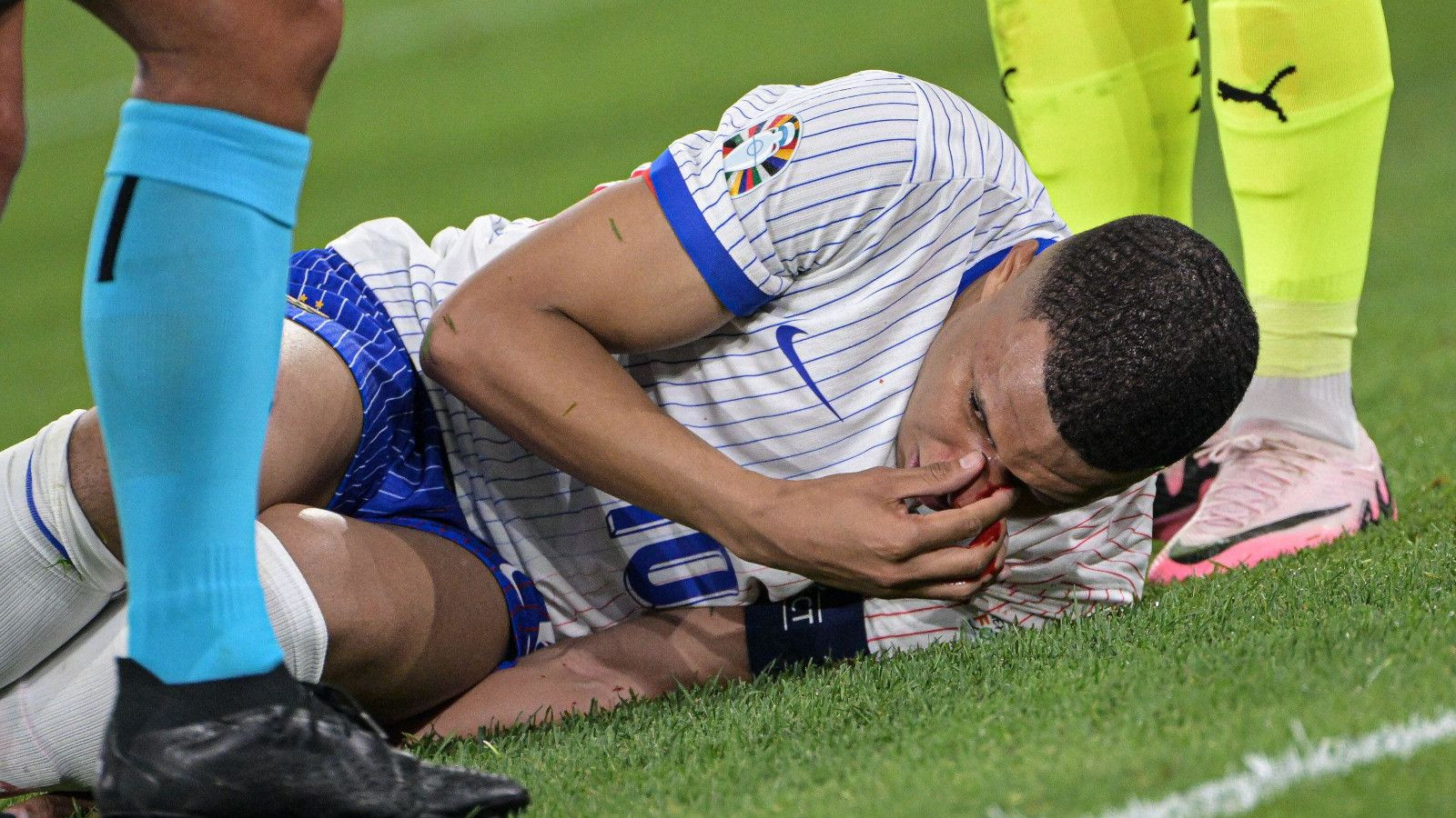 Euro 2024: France's Kylian Mbappe to play in mask due to broken nose