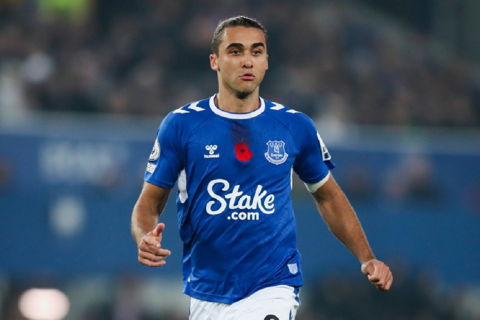 Sean Dyche: Dominic Calvert-Lewin must embrace the pressure of guiding ...